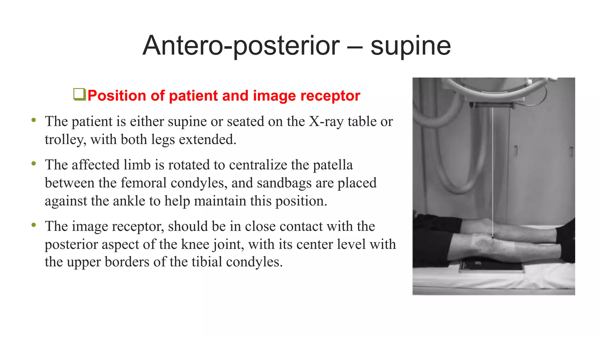 ANATOMY AND POSITIONING OF KNEE.pptx
