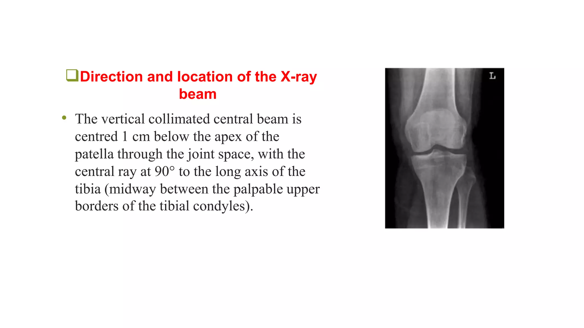 ANATOMY AND POSITIONING OF KNEE.pptx