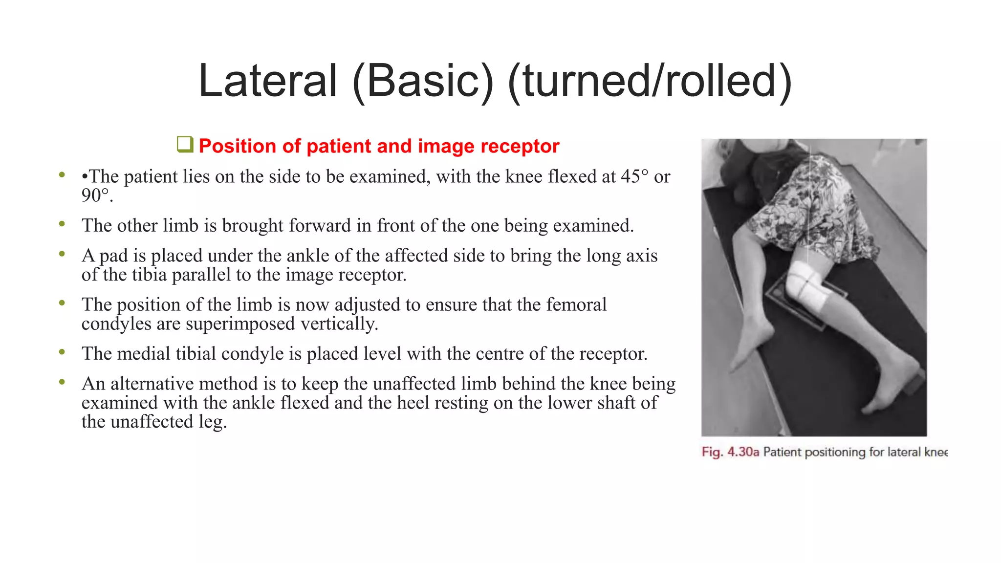 ANATOMY AND POSITIONING OF KNEE.pptx