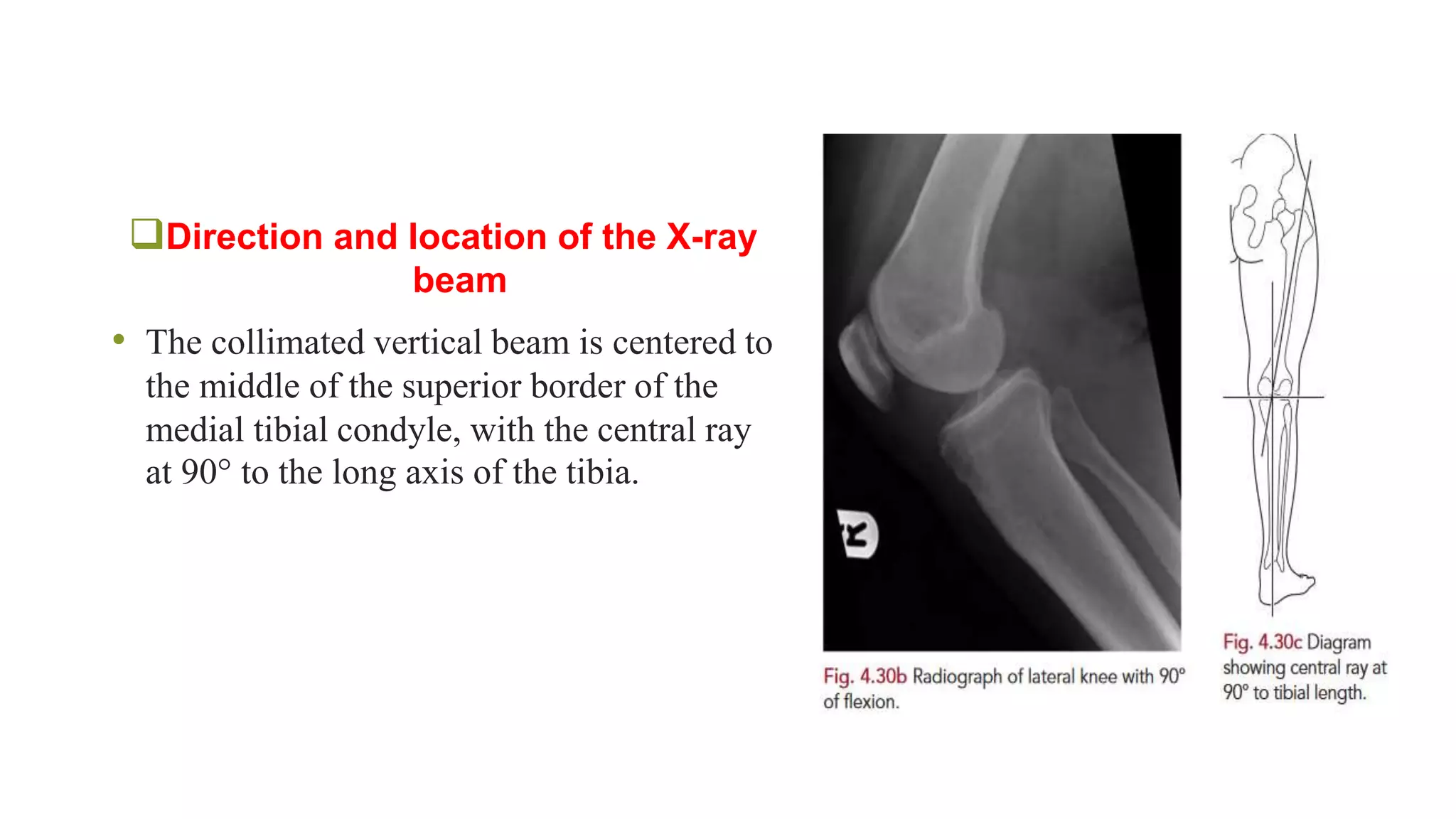 ANATOMY AND POSITIONING OF KNEE.pptx