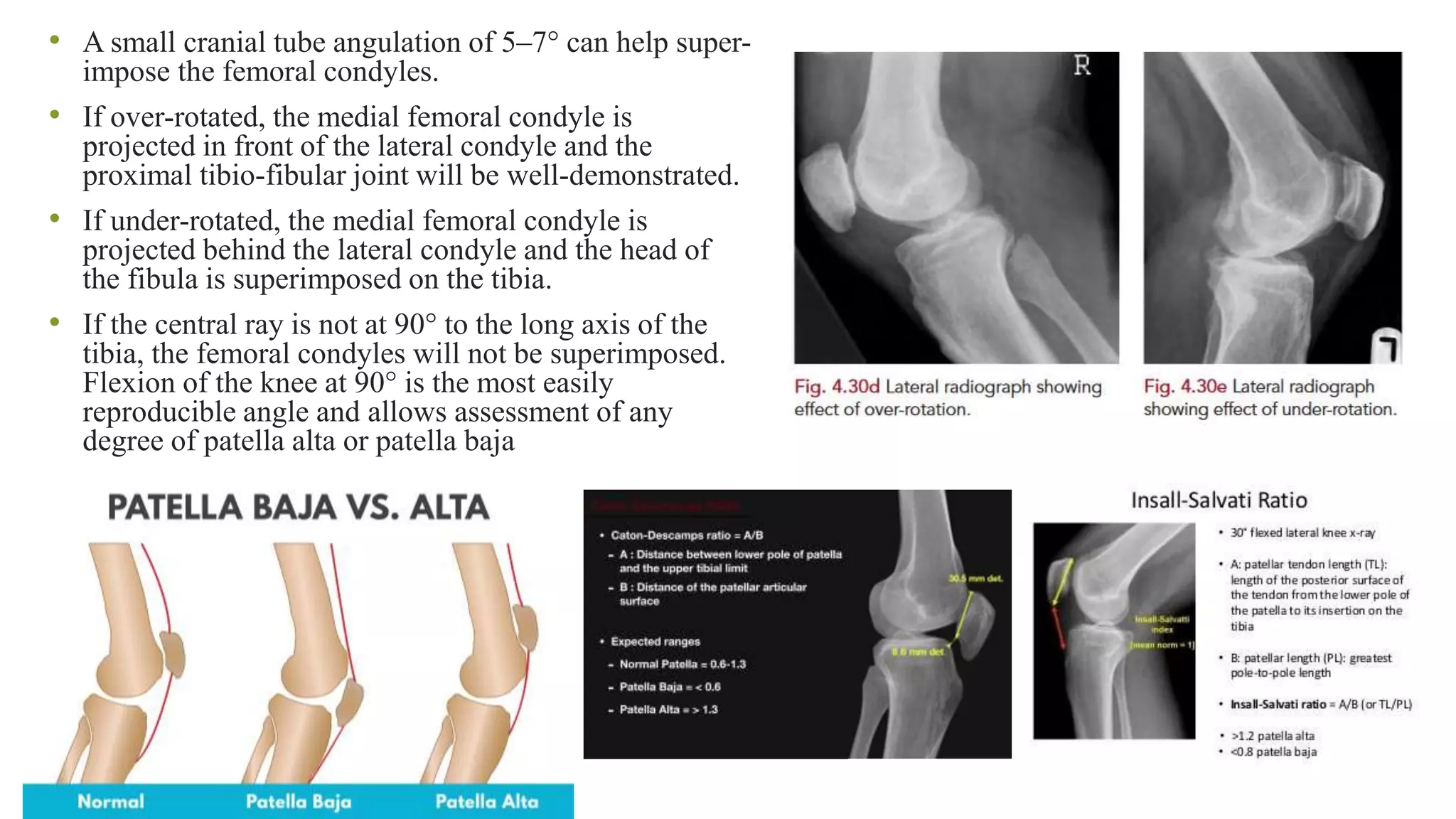 ANATOMY AND POSITIONING OF KNEE.pptx