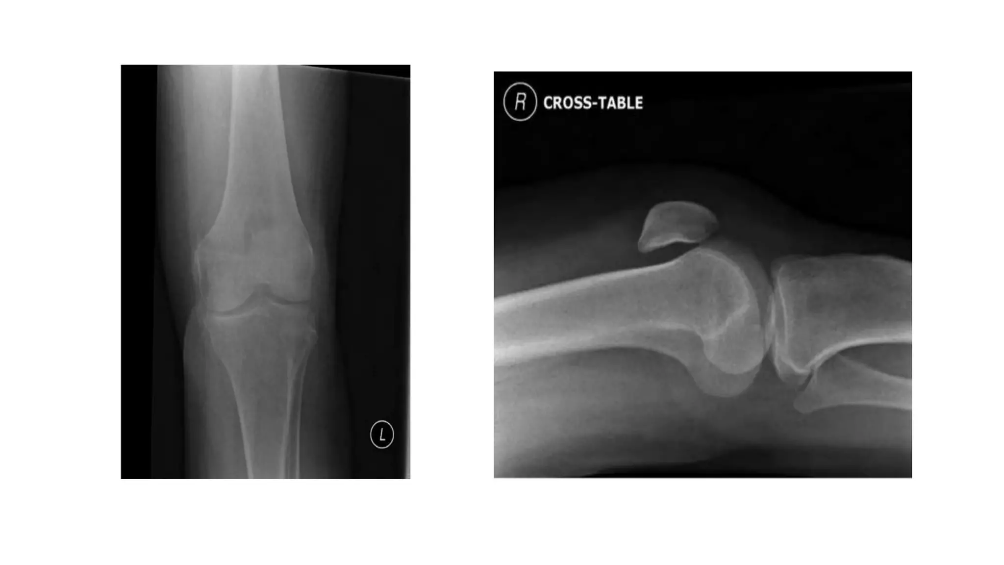 ANATOMY AND POSITIONING OF KNEE.pptx