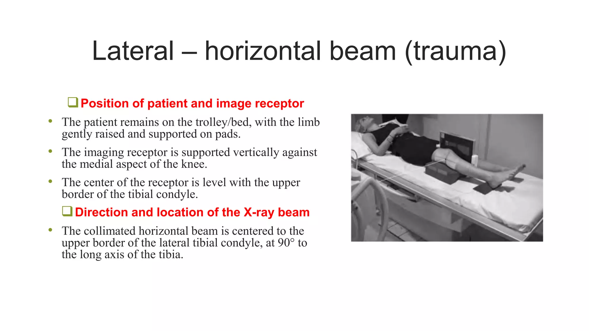 ANATOMY AND POSITIONING OF KNEE.pptx
