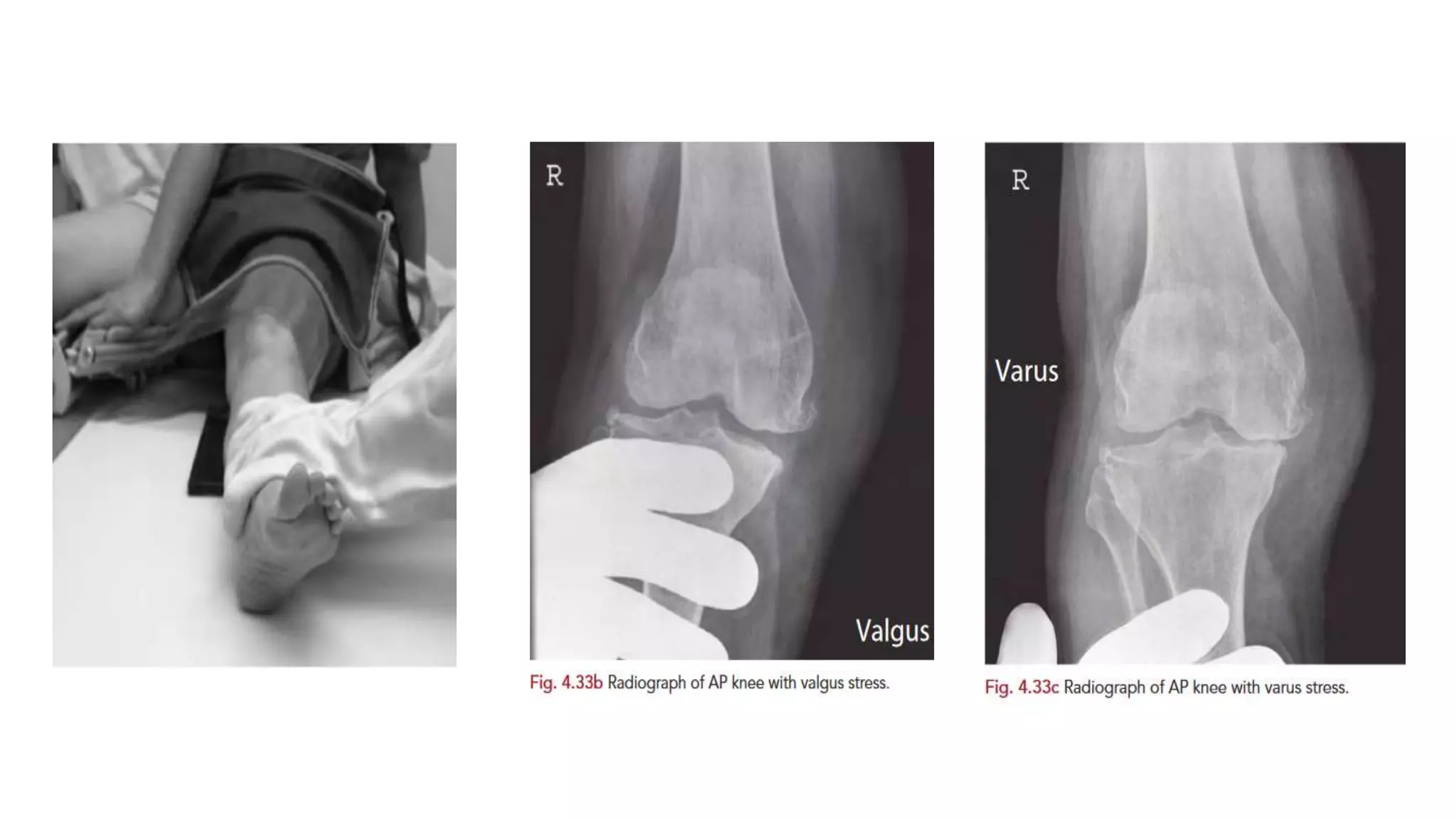 ANATOMY AND POSITIONING OF KNEE.pptx