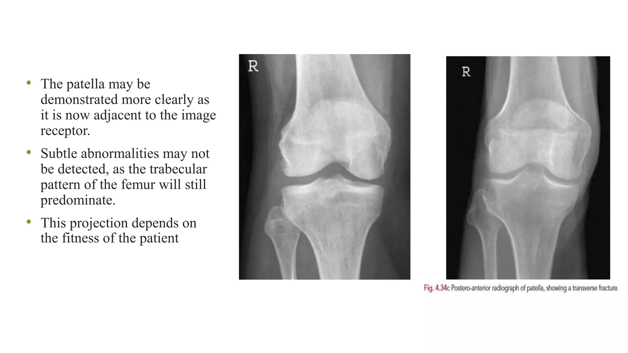 ANATOMY AND POSITIONING OF KNEE.pptx