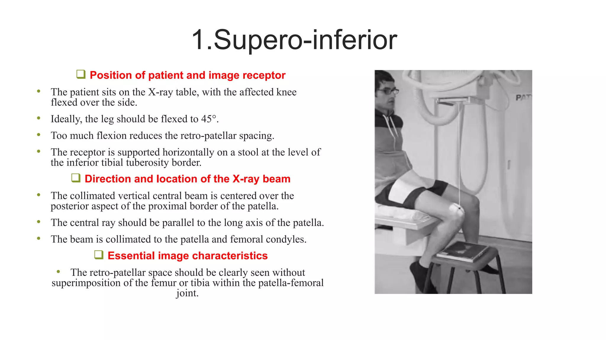 ANATOMY AND POSITIONING OF KNEE.pptx