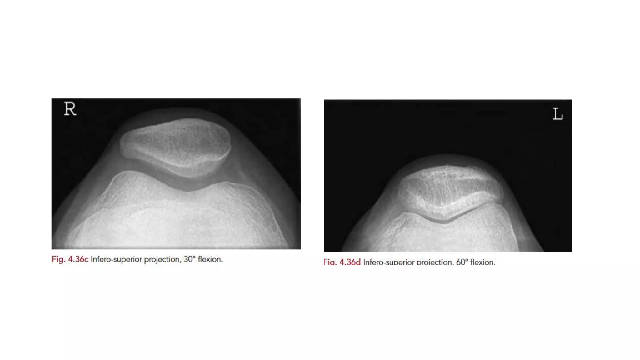 ANATOMY AND POSITIONING OF KNEE.pptx