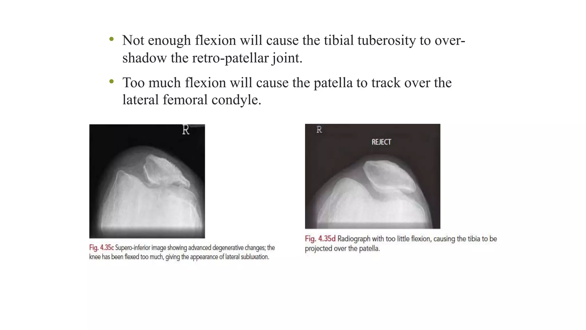 ANATOMY AND POSITIONING OF KNEE.pptx