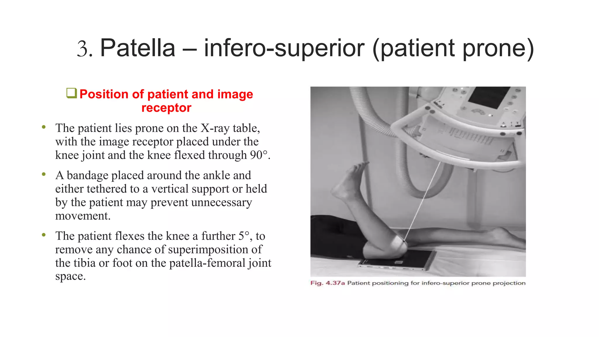ANATOMY AND POSITIONING OF KNEE.pptx