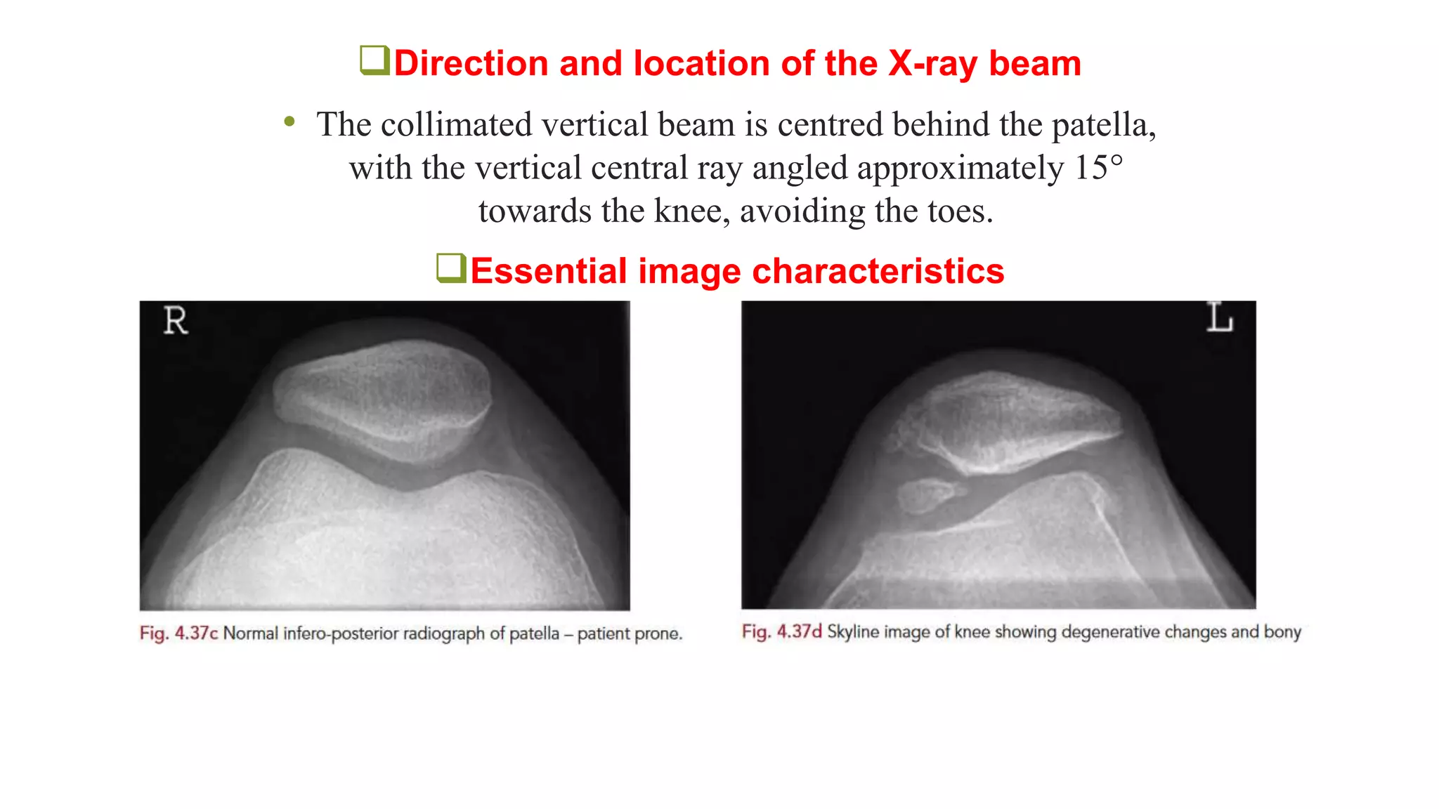 ANATOMY AND POSITIONING OF KNEE.pptx