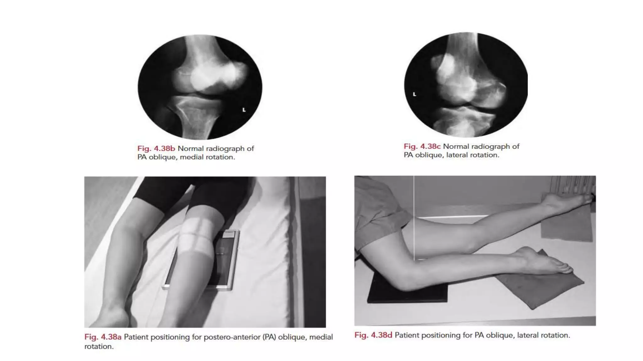 ANATOMY AND POSITIONING OF KNEE.pptx