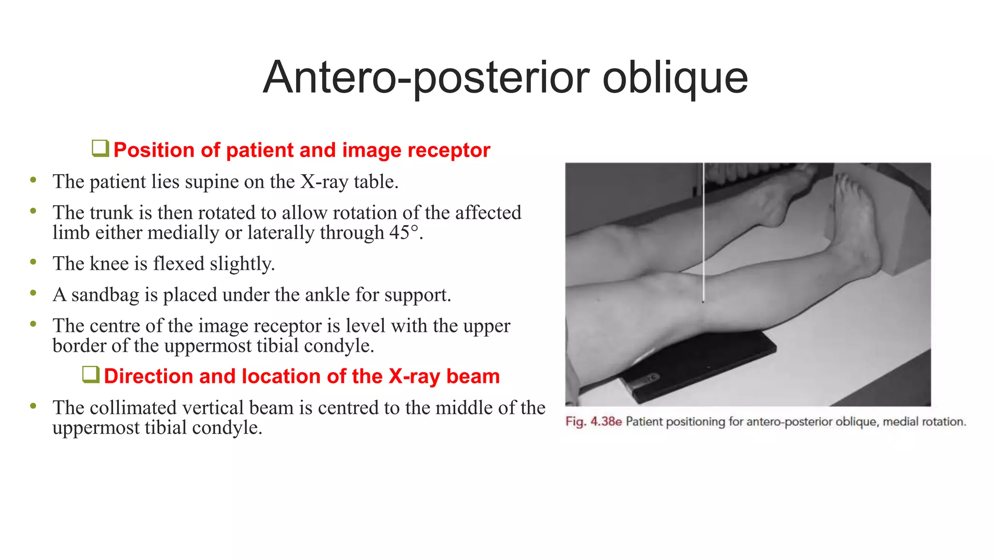 ANATOMY AND POSITIONING OF KNEE.pptx