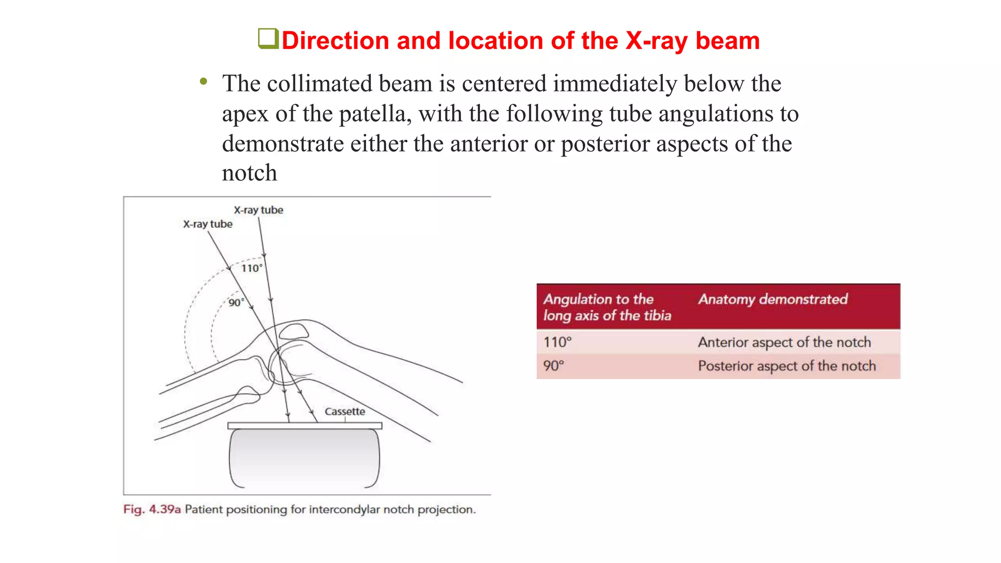 ANATOMY AND POSITIONING OF KNEE.pptx