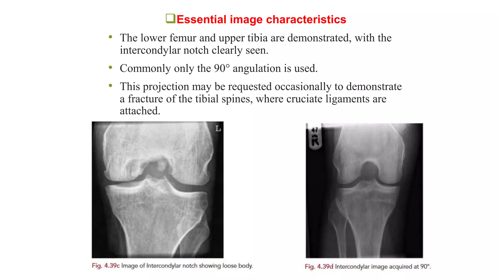 ANATOMY AND POSITIONING OF KNEE.pptx
