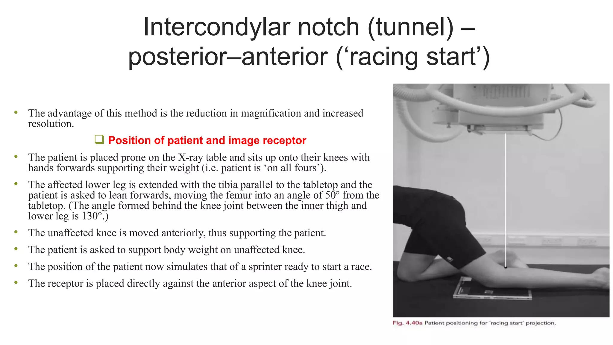 ANATOMY AND POSITIONING OF KNEE.pptx
