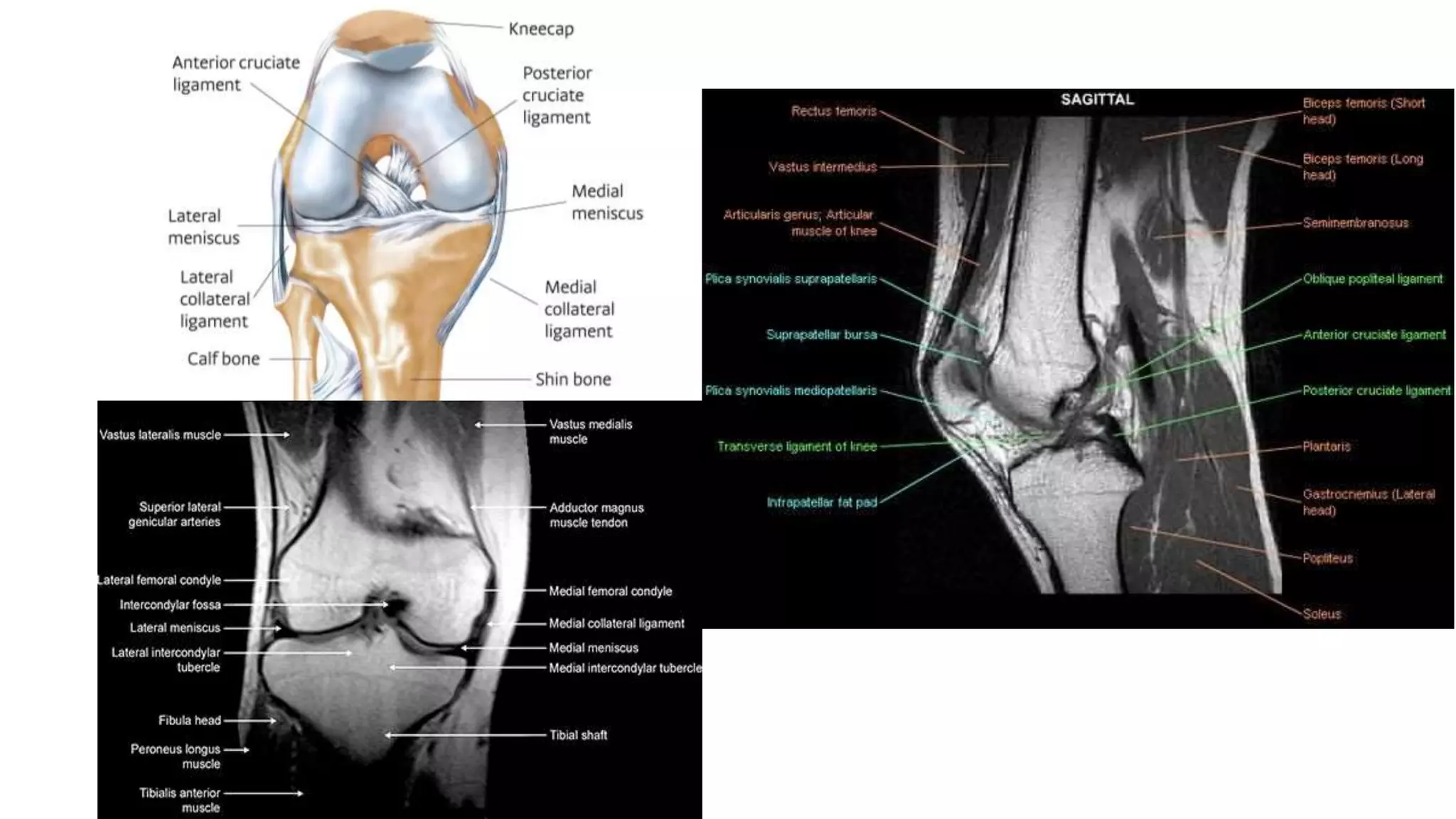 ANATOMY AND POSITIONING OF KNEE.pptx