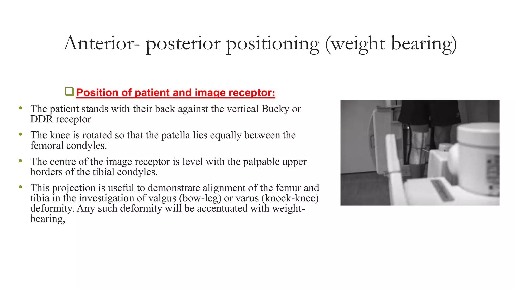 ANATOMY AND POSITIONING OF KNEE.pptx