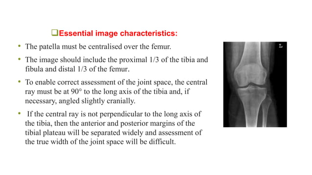 ANATOMY AND POSITIONING OF KNEE.pptx | Death, Injury, or Military Conflict | Sensitive Topics