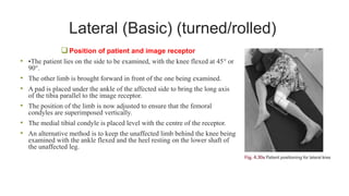 ANATOMY AND POSITIONING OF KNEE.pptx