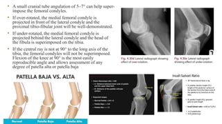 ANATOMY AND POSITIONING OF KNEE.pptx