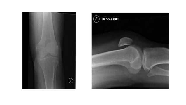 ANATOMY AND POSITIONING OF KNEE.pptx | Death, Injury, or Military ...