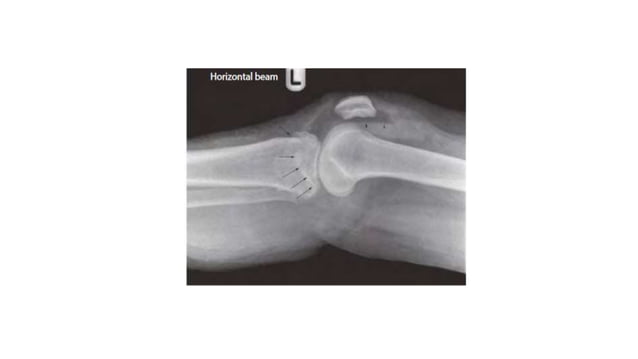 ANATOMY AND POSITIONING OF KNEE.pptx | Death, Injury, or Military ...