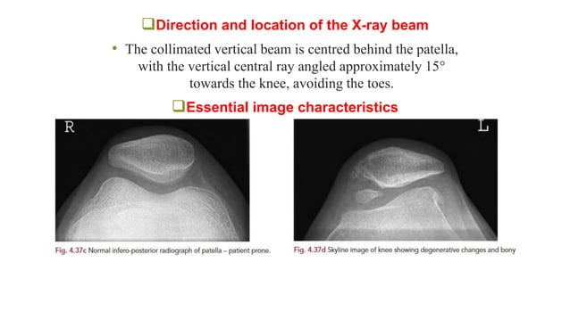ANATOMY AND POSITIONING OF KNEE.pptx | Death, Injury, or Military ...