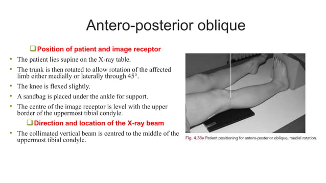 ANATOMY AND POSITIONING OF KNEE.pptx | Death, Injury, or Military ...