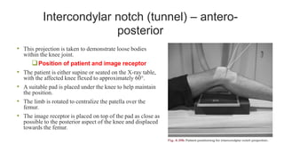 ANATOMY AND POSITIONING OF KNEE.pptx