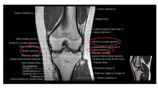 ANATOMY AND POSITIONING OF KNEE.pptx