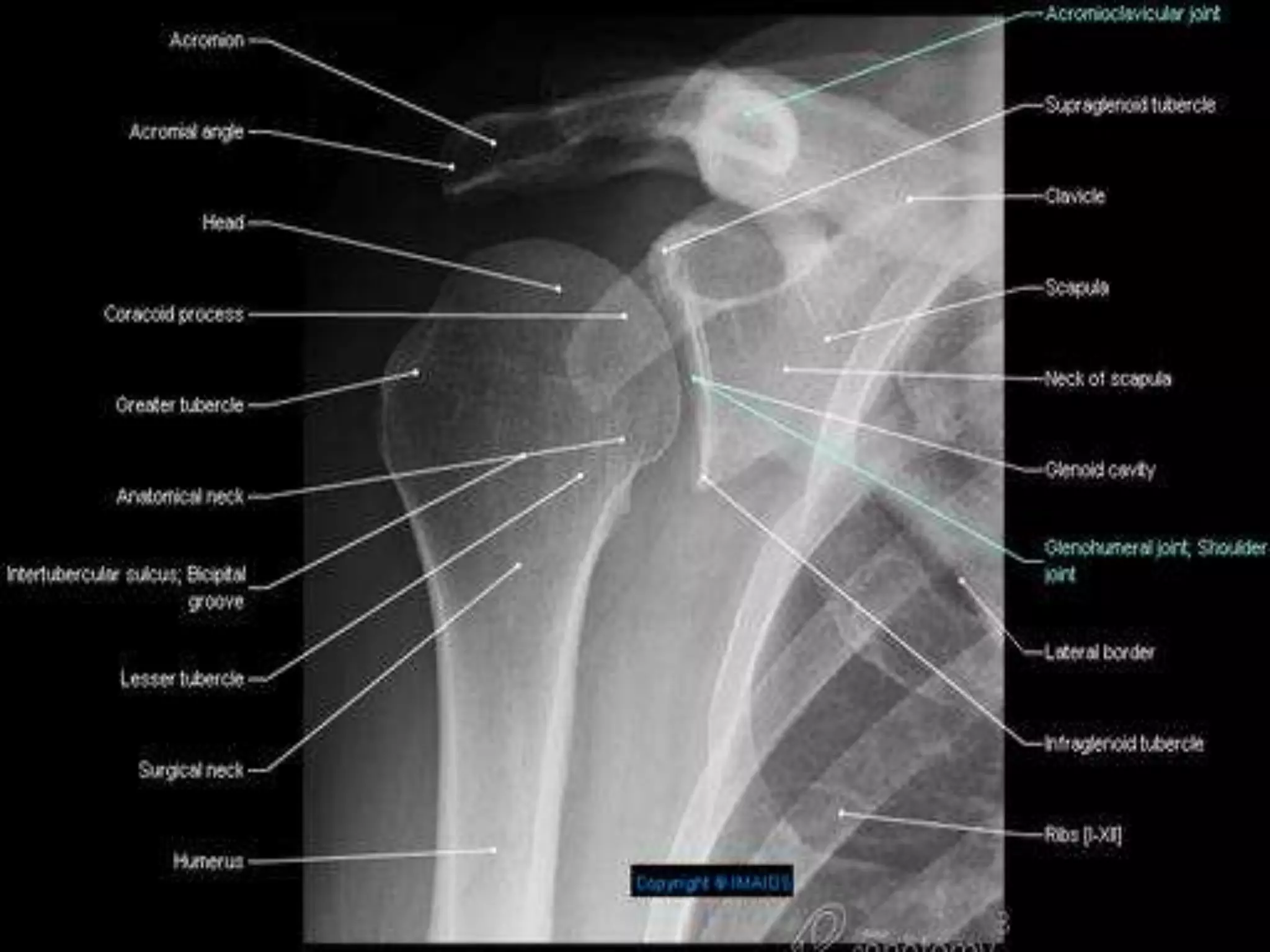 Anatomy and Radiography of shoulder and arm | PPTX