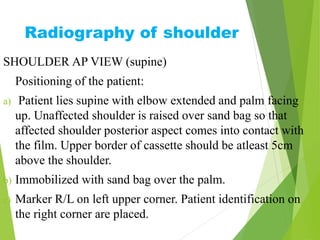 Anatomy and Radiography of shoulder and arm | PPTX