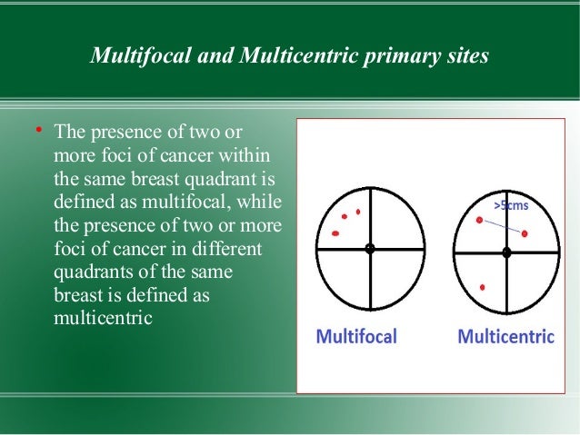 Anatomy and staging breast cancer