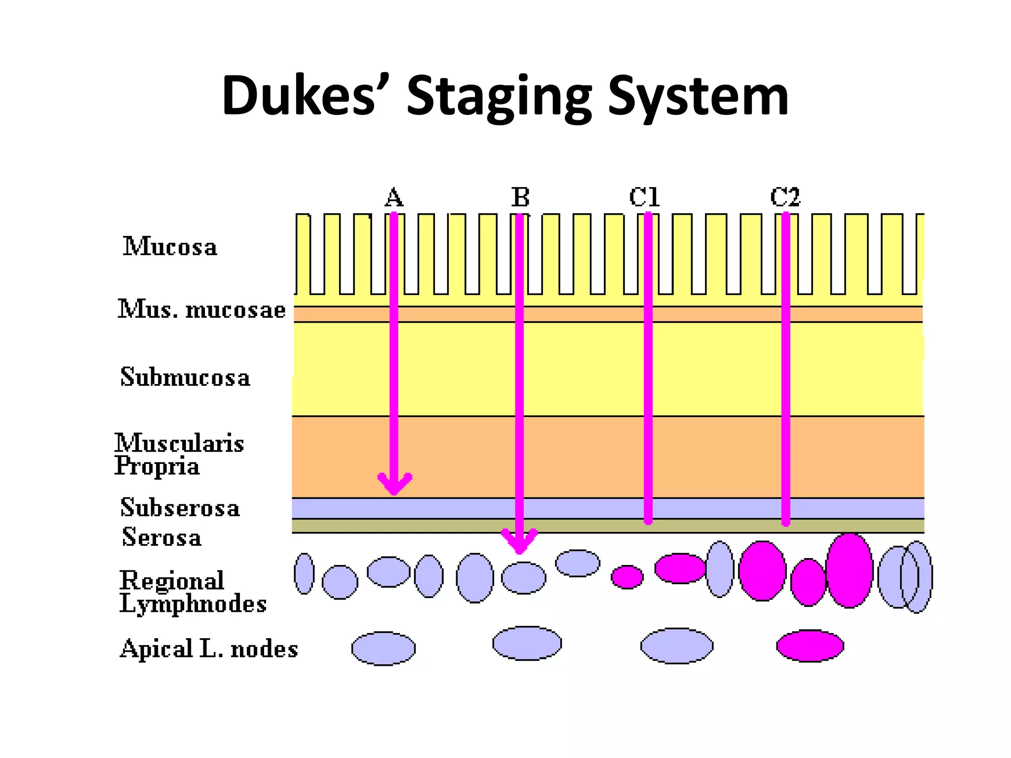 Anatomy and staging of ca colon | PPTX