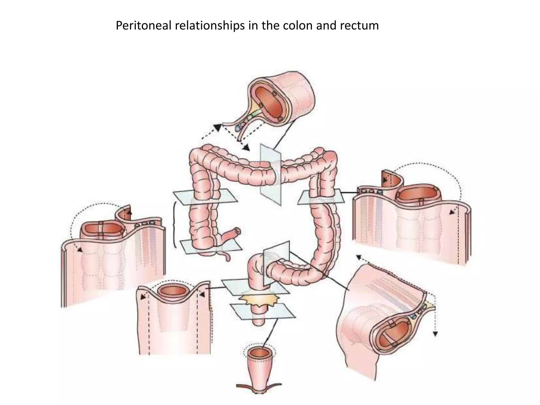 Anatomy and staging of ca colon | PPTX