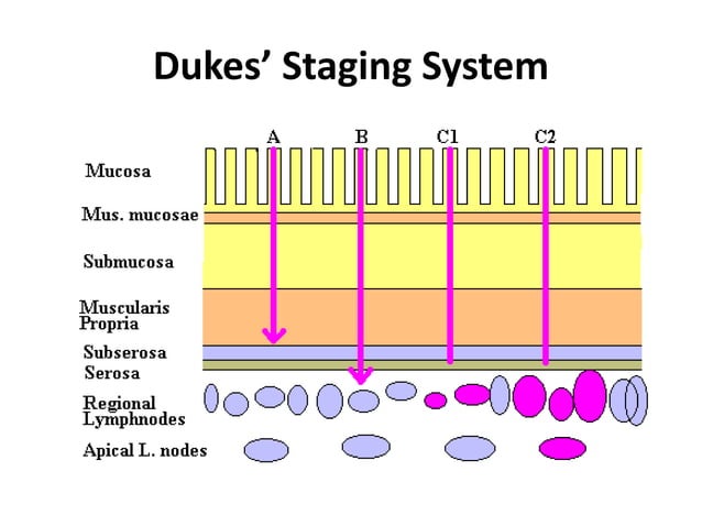 Anatomy and staging of ca colon | PPTX