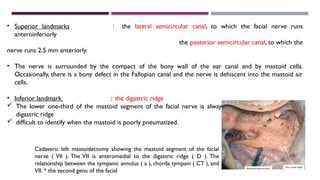 anatomy and tests of facial nerve -asps-1.pptx