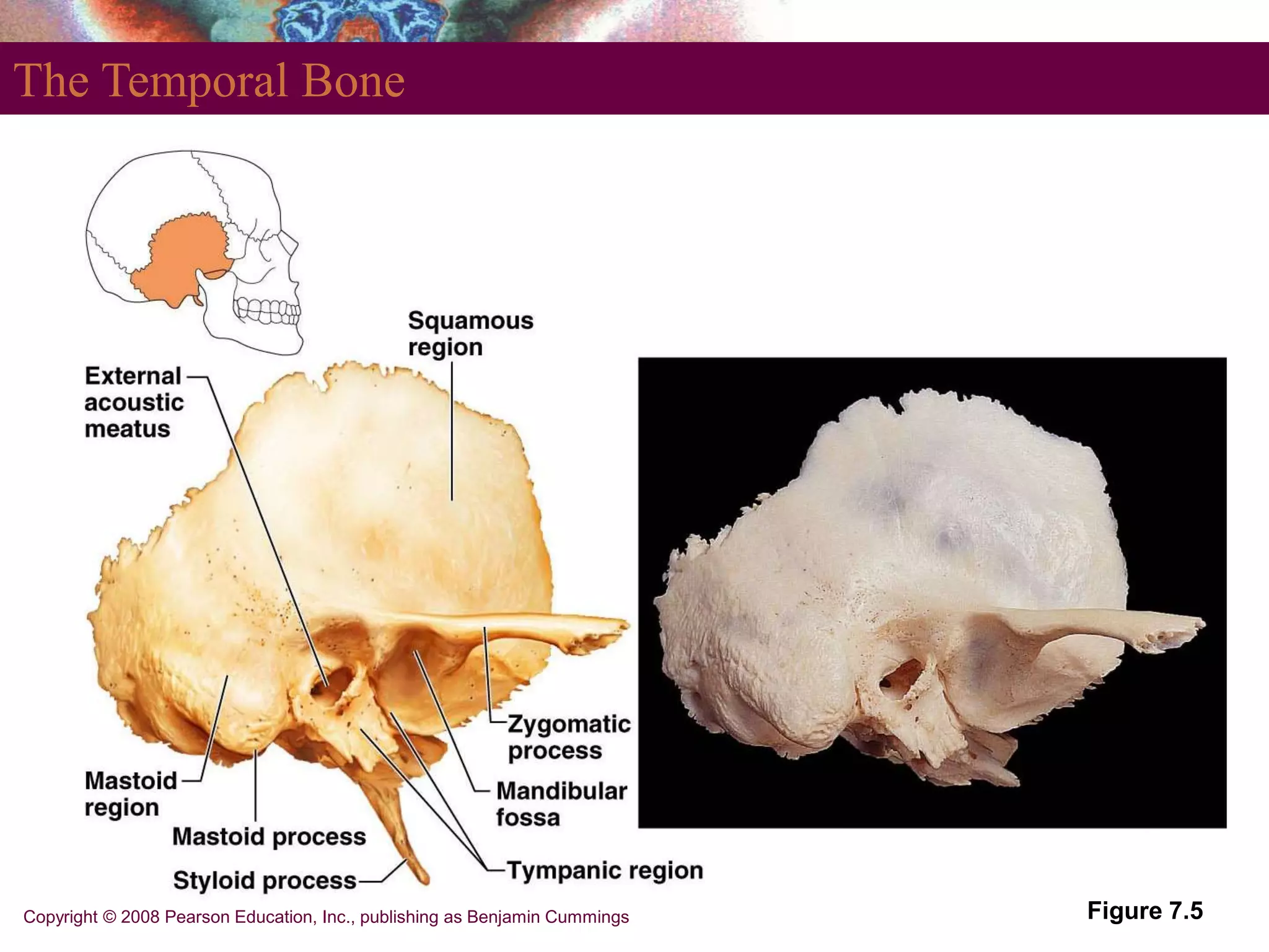 anatomy_axial_skeleton_pearson.ppt
