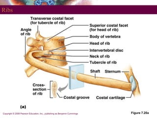 anatomy_axial_skeleton_pearson.ppt | Death, Injury, or Military ...