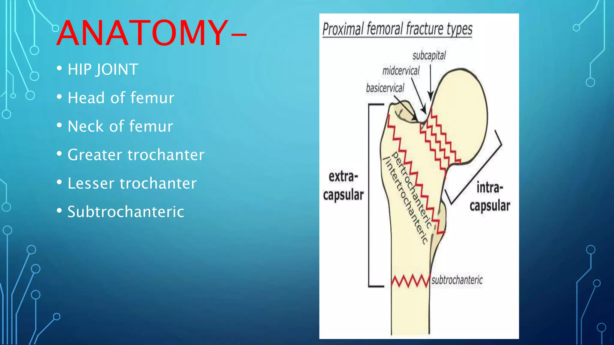 Anatomy,Biomechanics & surgical approaches of proximal femur | PPTX