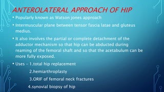 Anatomy,Biomechanics & surgical approaches of proximal femur | PPT