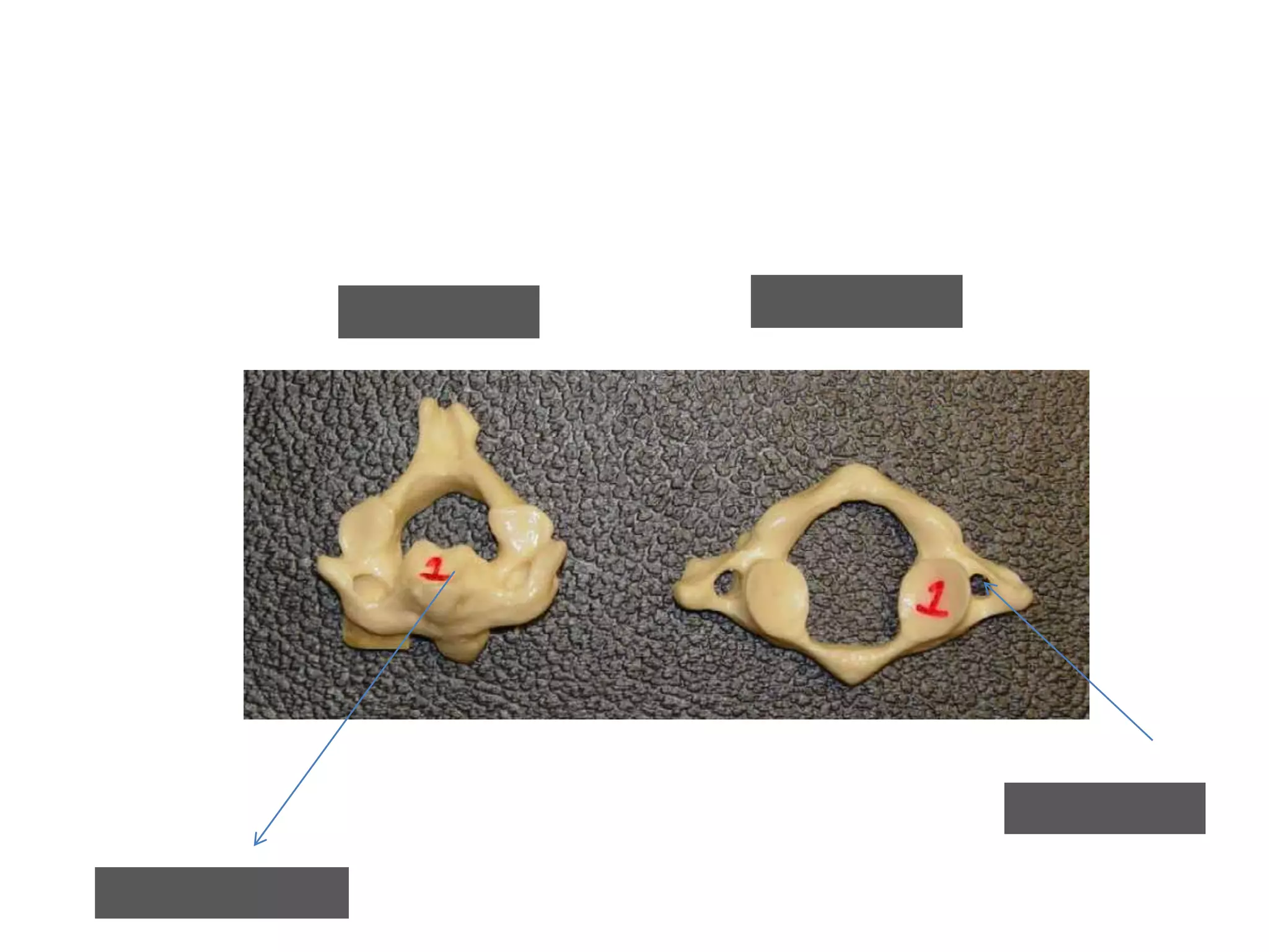 Anatomy bone test | PPTX