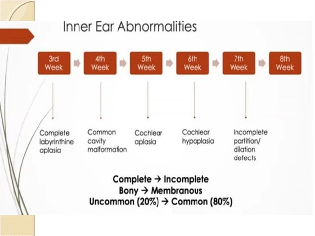 anatomy congenital anomalies inner earrr.pptx