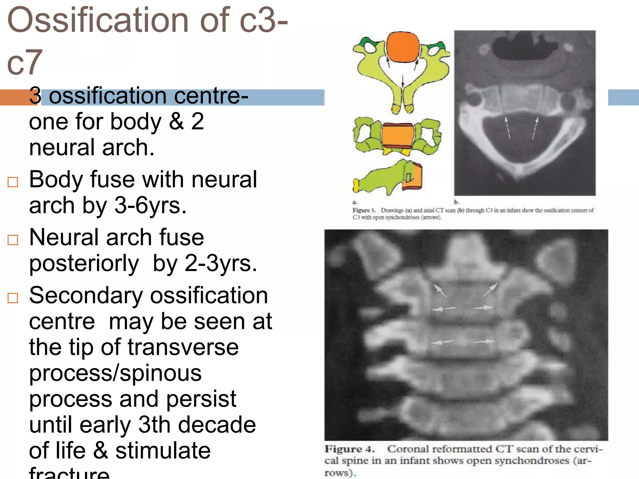 Anatomy c spine | PPTX