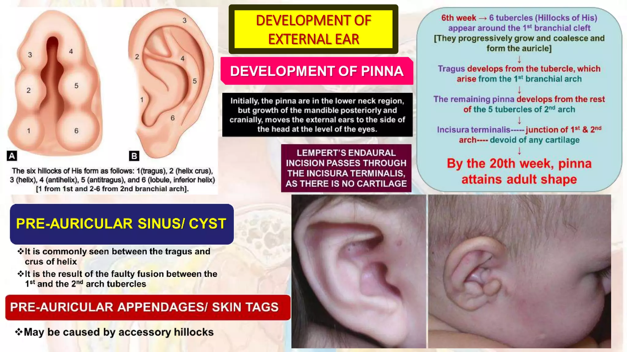 ANATOMY & DEVELOPMENT OF EXTERNAL EAR | PPTX