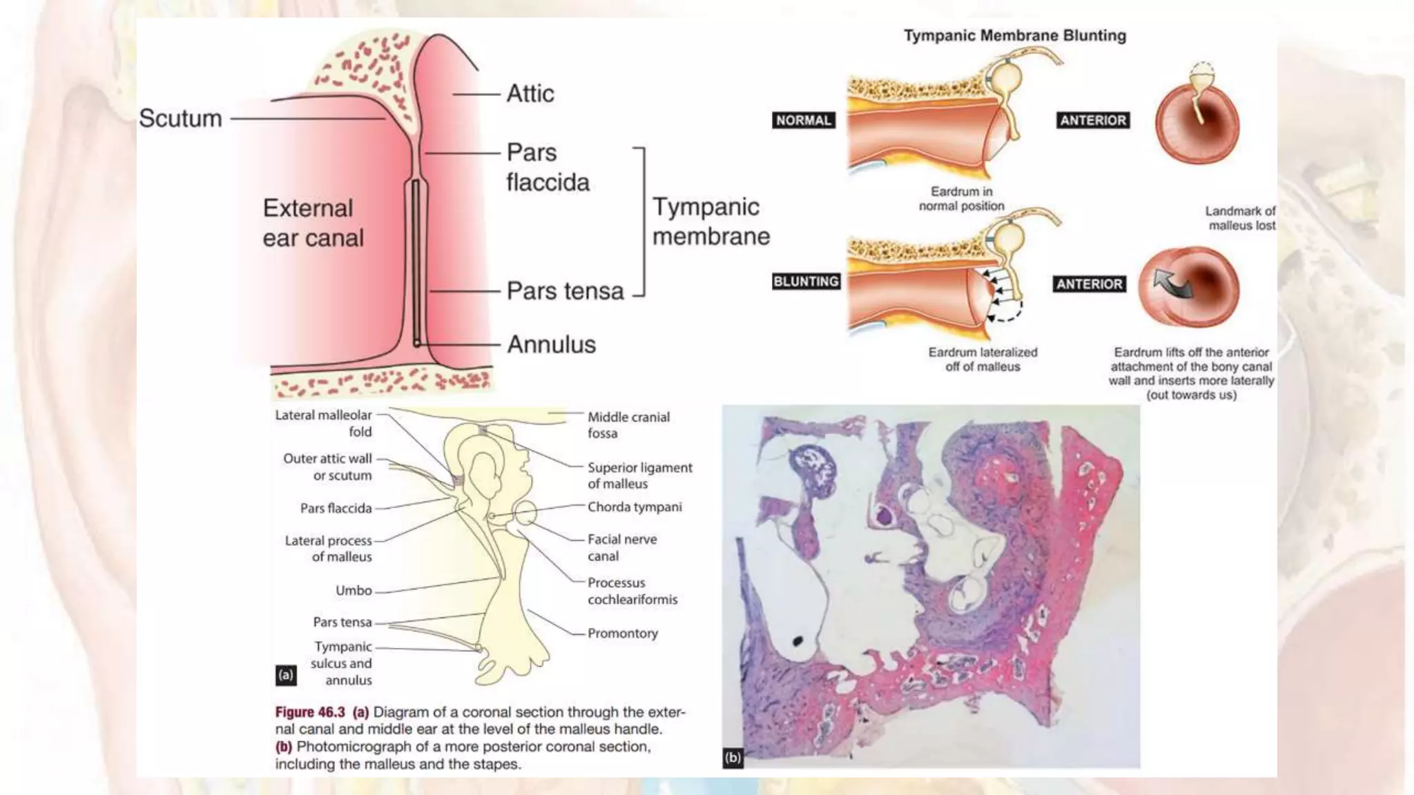 ANATOMY & DEVELOPMENT OF EXTERNAL EAR | PPTX