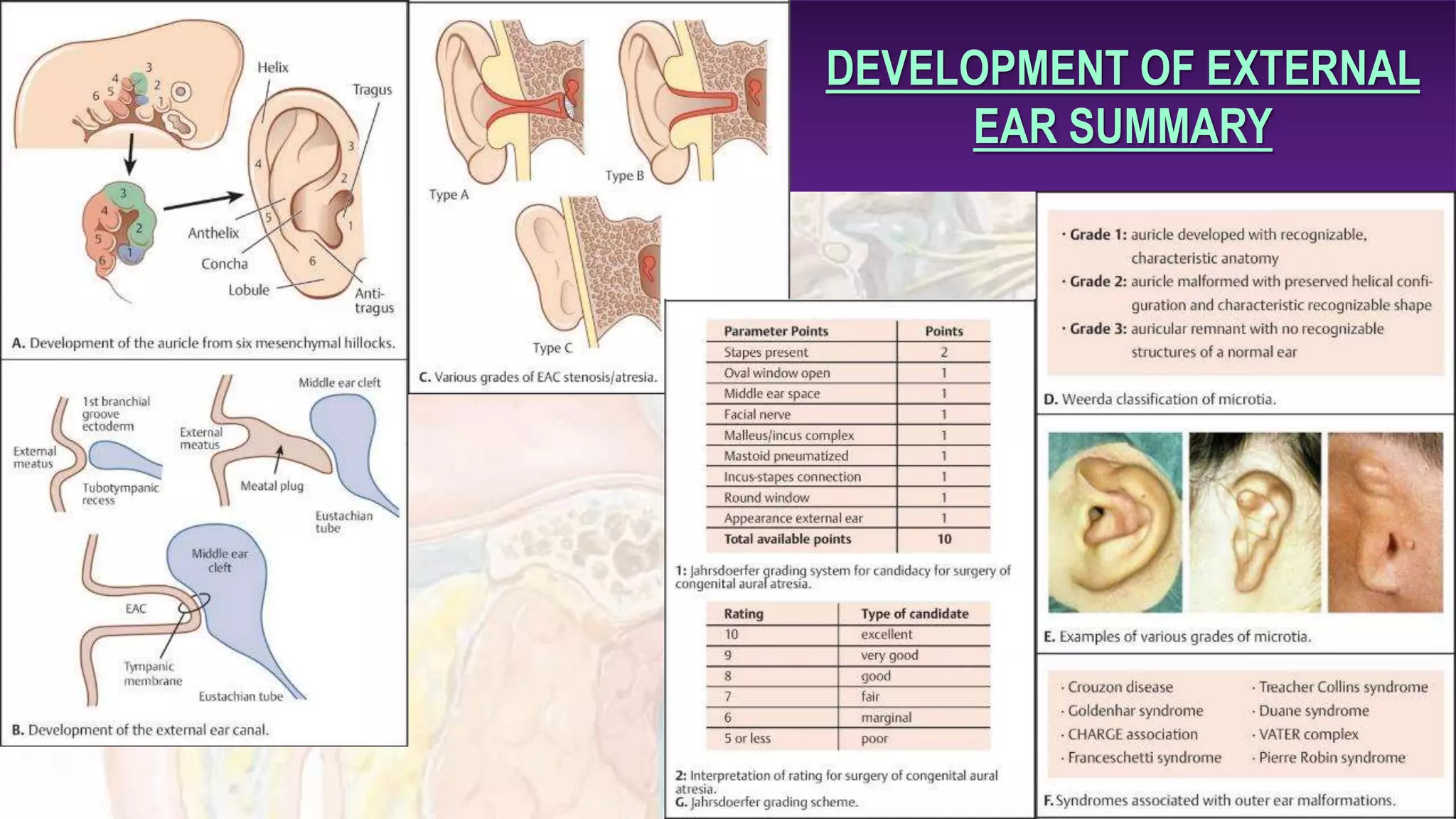 ANATOMY & DEVELOPMENT OF EXTERNAL EAR | PPTX