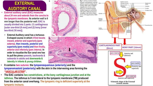 ANATOMY & DEVELOPMENT OF EXTERNAL EAR | PPTX