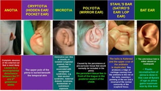 ANATOMY & DEVELOPMENT OF EXTERNAL EAR | PPTX