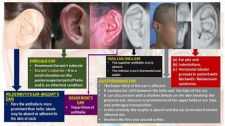 ANATOMY & DEVELOPMENT OF EXTERNAL EAR | PPTX